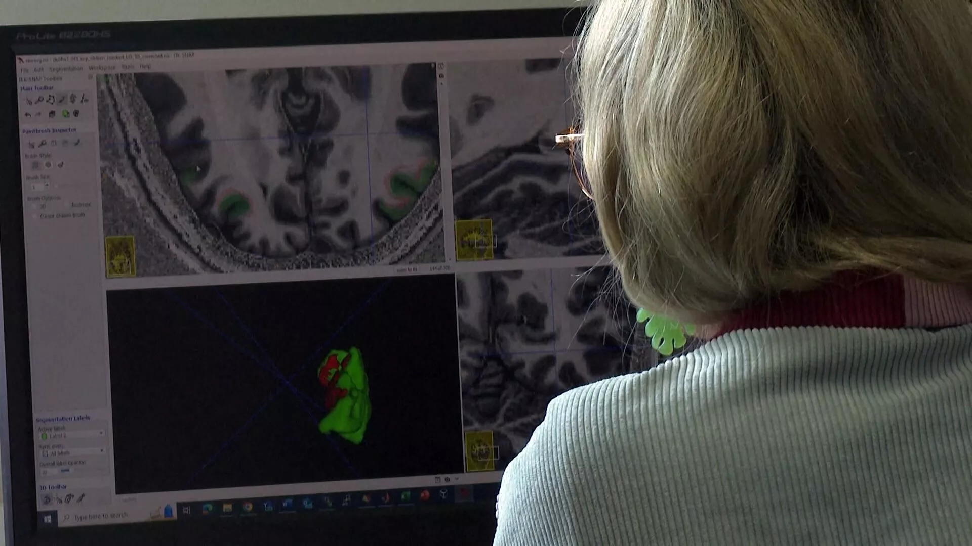 Organisasi medis menemukan 14 faktor risiko demensia ｜ 公視新聞網 PNN